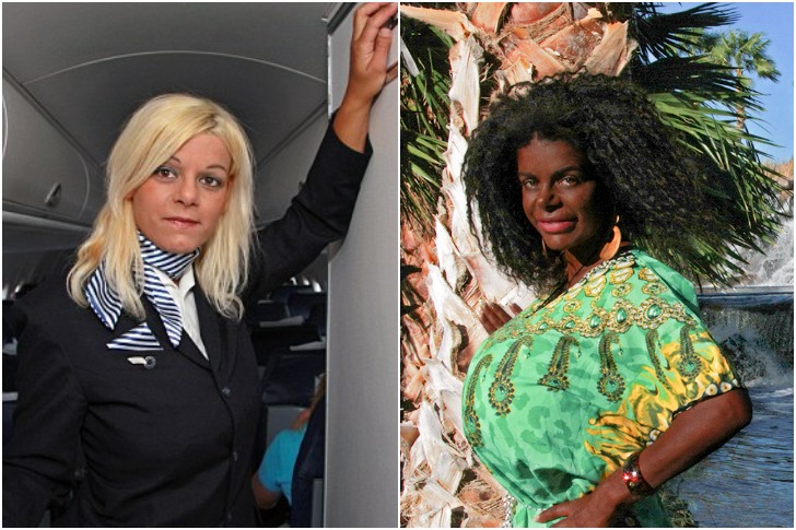 Botox, Schönheits-OPs oder einfach nur das Alter: So haben sich unsere ...