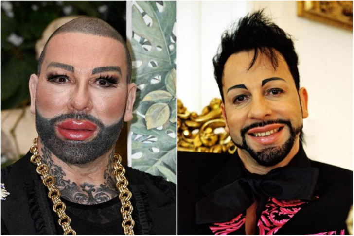 PROMIS AUF DIÄT: SO SEHEN SIE IM VORHER/NACHHER VERGLEICH AUS - Page 4 ...